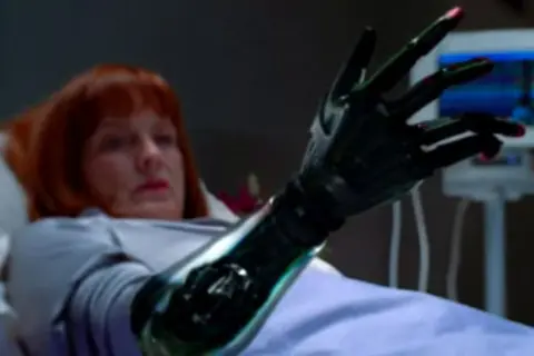 Fringe: A Robotic, Prosthetic Hand (a la Darth, Luke, etc) | Discover ...