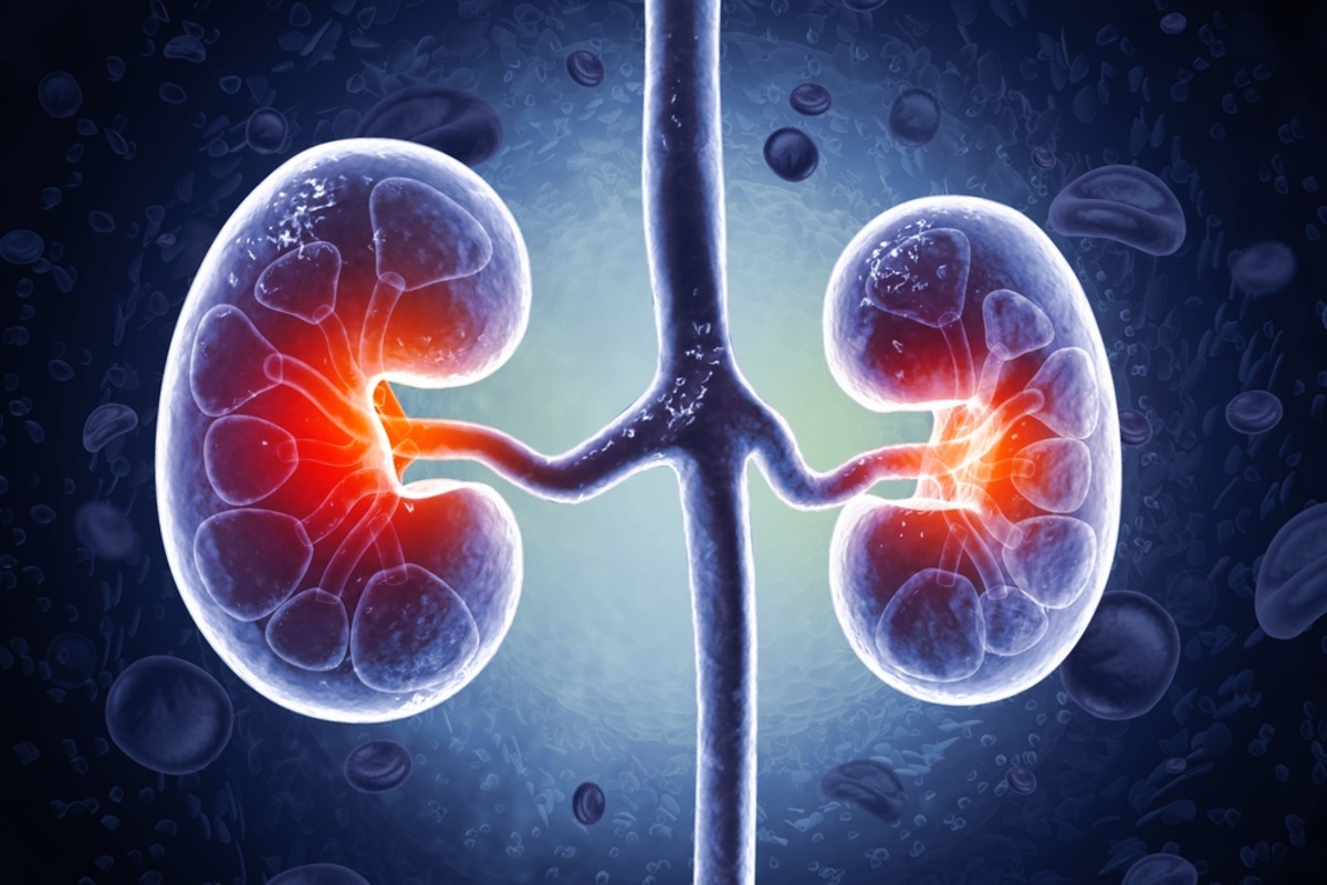 Over 800 Million People Have Chronic Kidney Disease but Many Don’t Know ...