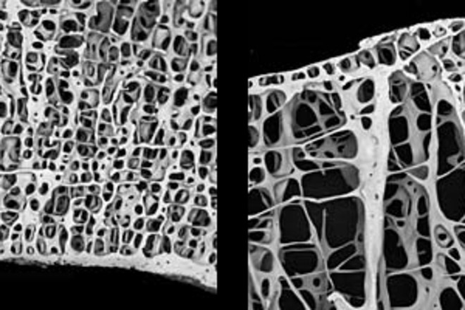 Vital Signs: Why Is He Limping? | Discover Magazine