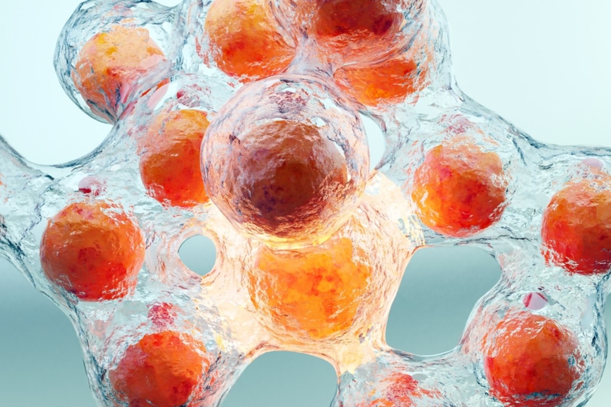 Fat Cells Can Retain a Genetic Memory — Even After Weight Loss ...