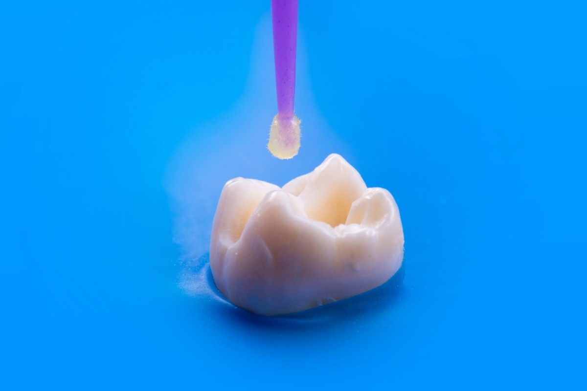 Regrowing Teeth Is on the Horizon and May Represent the Future of ...
