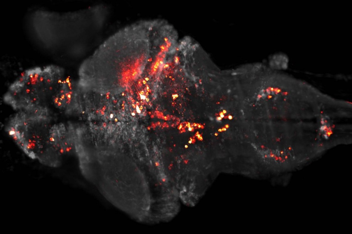 Watch This Brain Activity Illuminated In A Zebrafish Discover Magazine