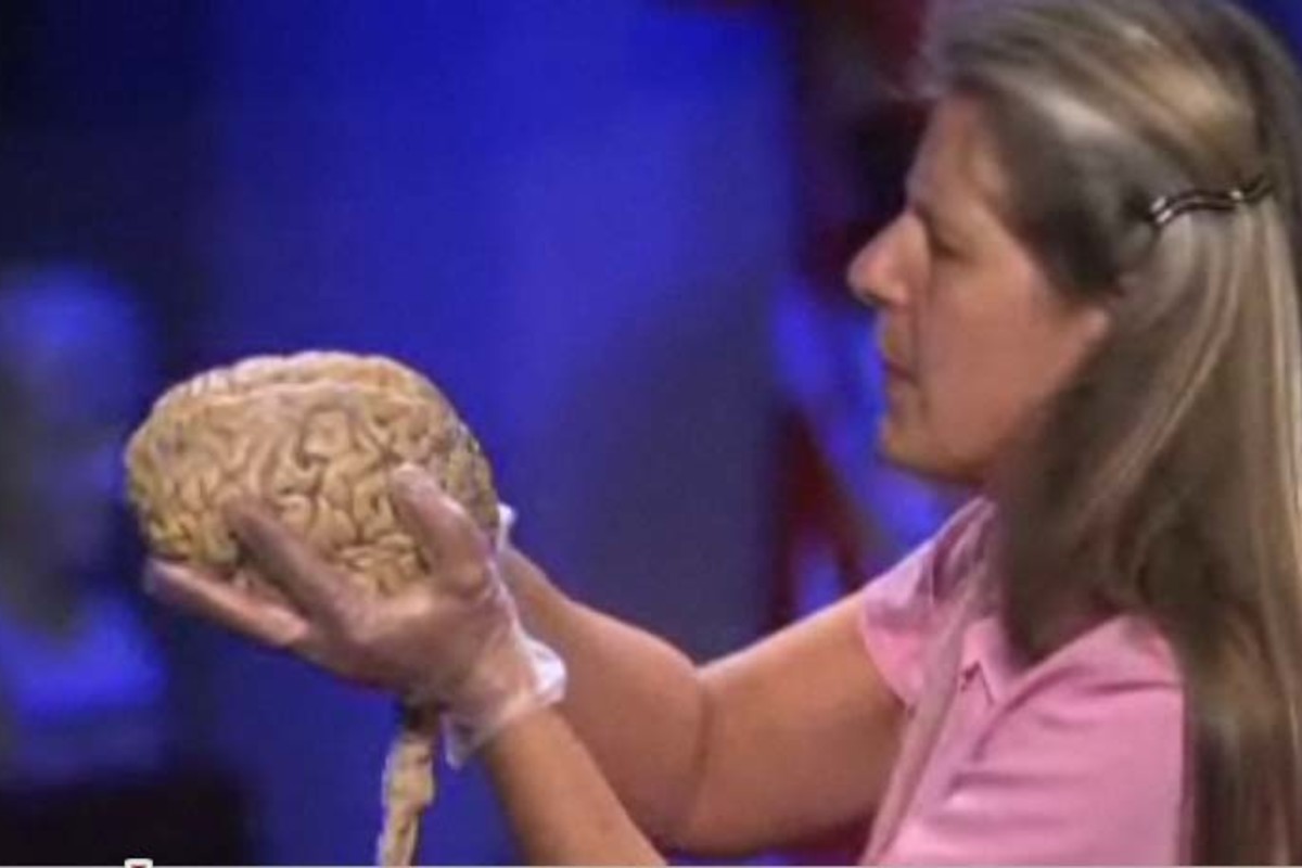 I Think I’m Having a Stroke… Cool! | Discover Magazine