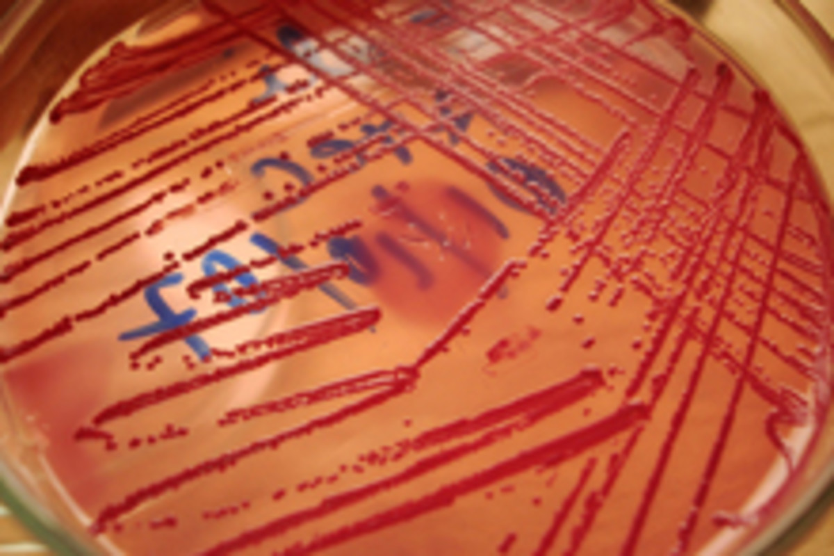 The “Piece of Paper” That Can Detect E. Coli | Discover Magazine