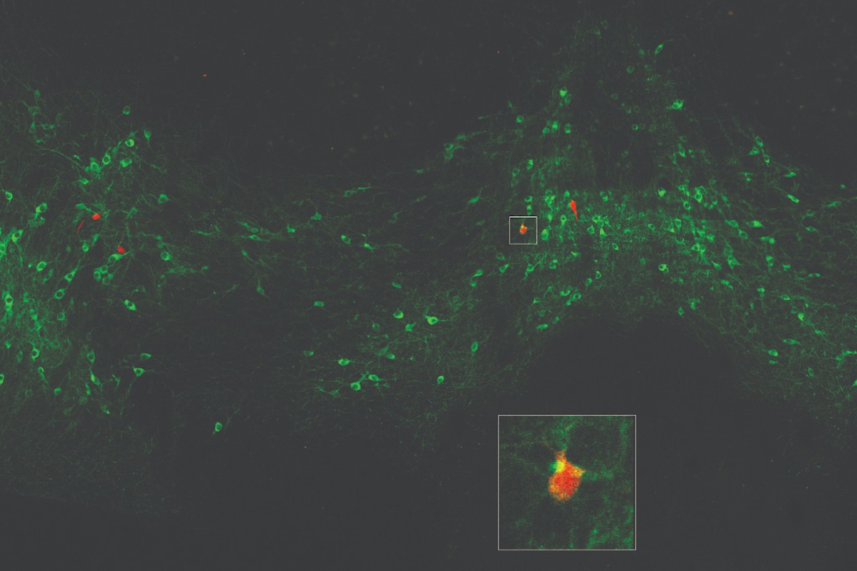 Mice Forget Their Fears Thanks to the Flow of Dopamine Through Their ...