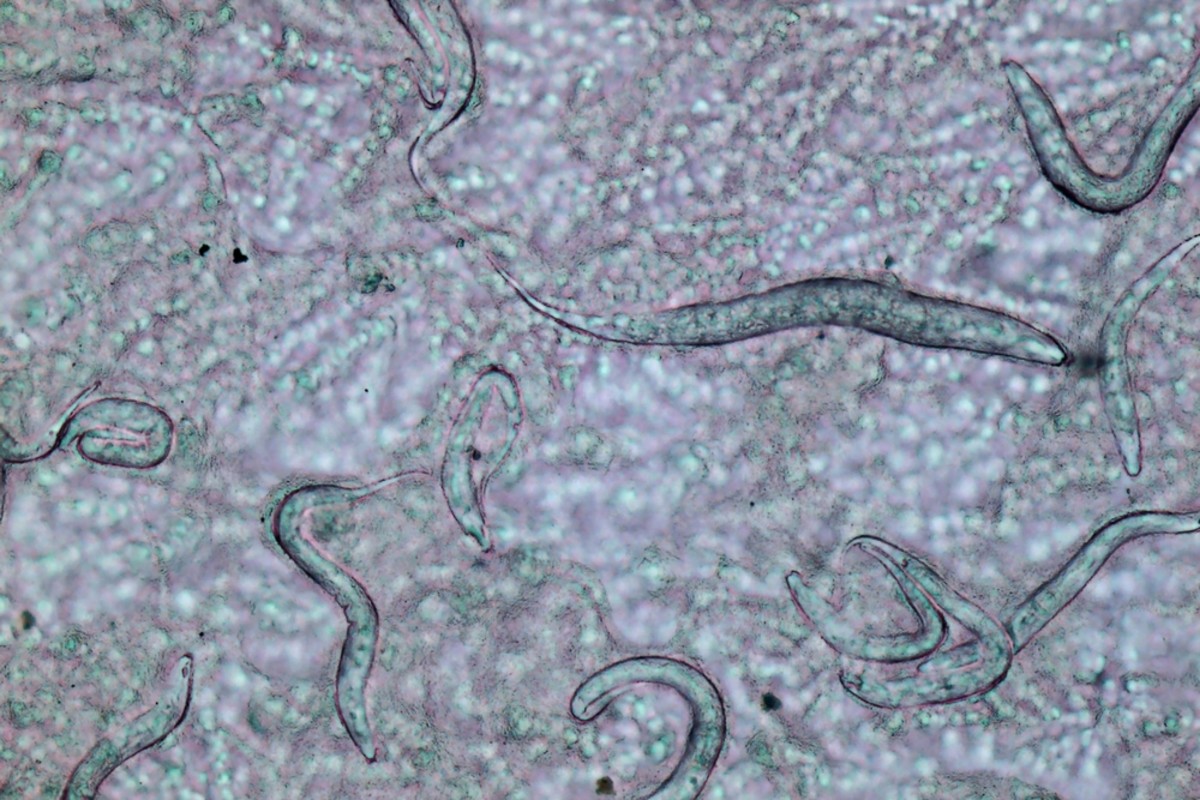 Worms Can Smell Death, and It Strangely Alters Their Fertility and ...