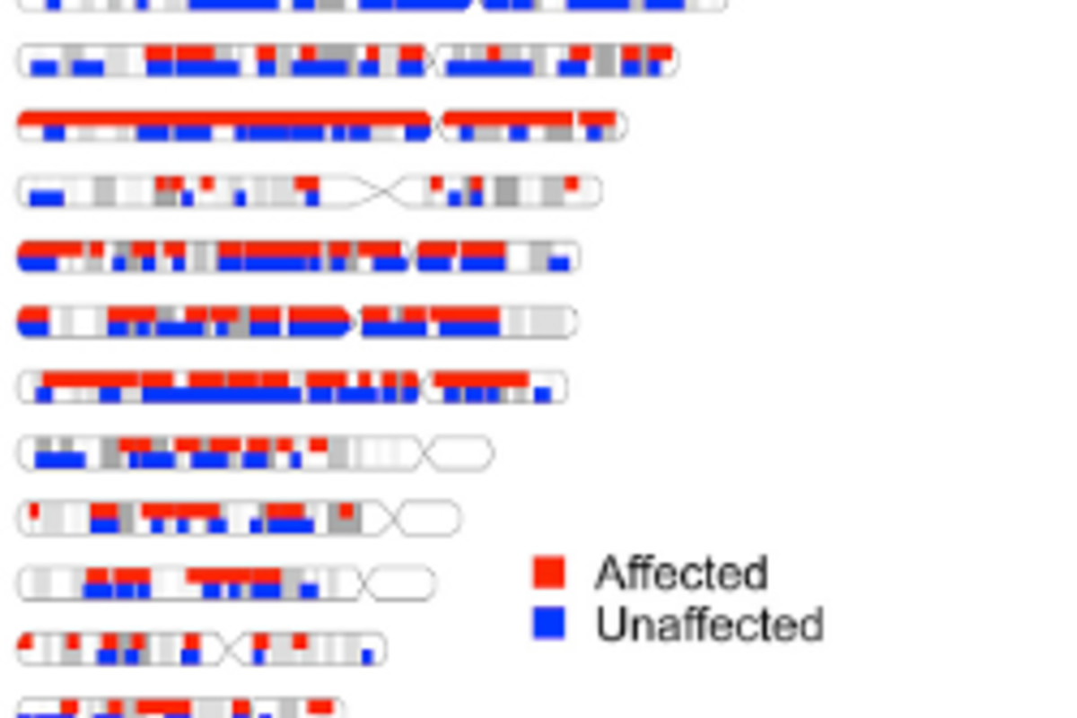 Genetic diversity and intellectual disability | Discover Magazine