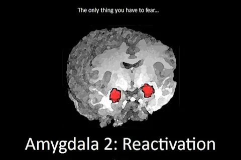 "Can I Have My Amygdala Removed?" | Discover Magazine