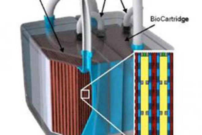 Researchers Plan to Build the World's First Implantable, Mechanical ...