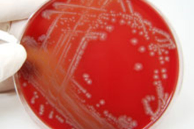 Engineered E. Coli Bacteria Produces Road-Ready Diesel | Discover Magazine