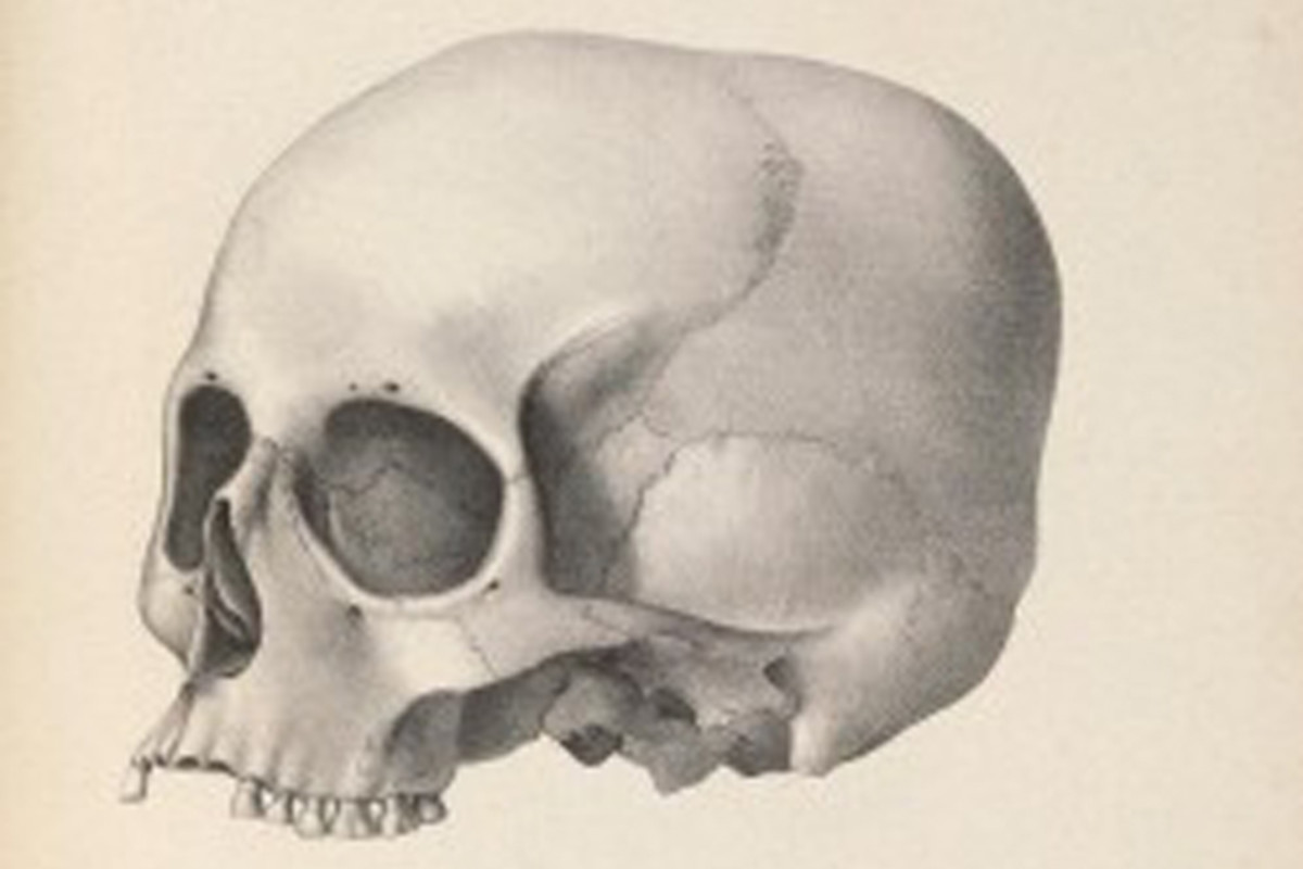 Lost Research Notes Clear Up Racial Bias Debate in Old Skull Size Study ...
