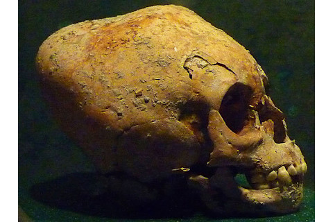 Tracing the History and Health Impacts of Skull Modification | Discover ...