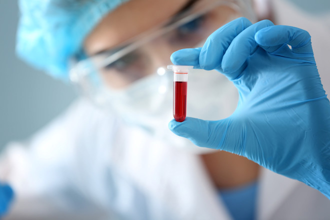 Scientists Find Success in Creating Lab-Grown Blood | Discover Magazine