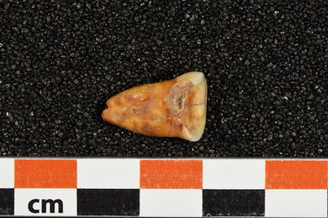 Ancient Teeth and Bones Show Stone Age People Consumed a Paleo Diet ...