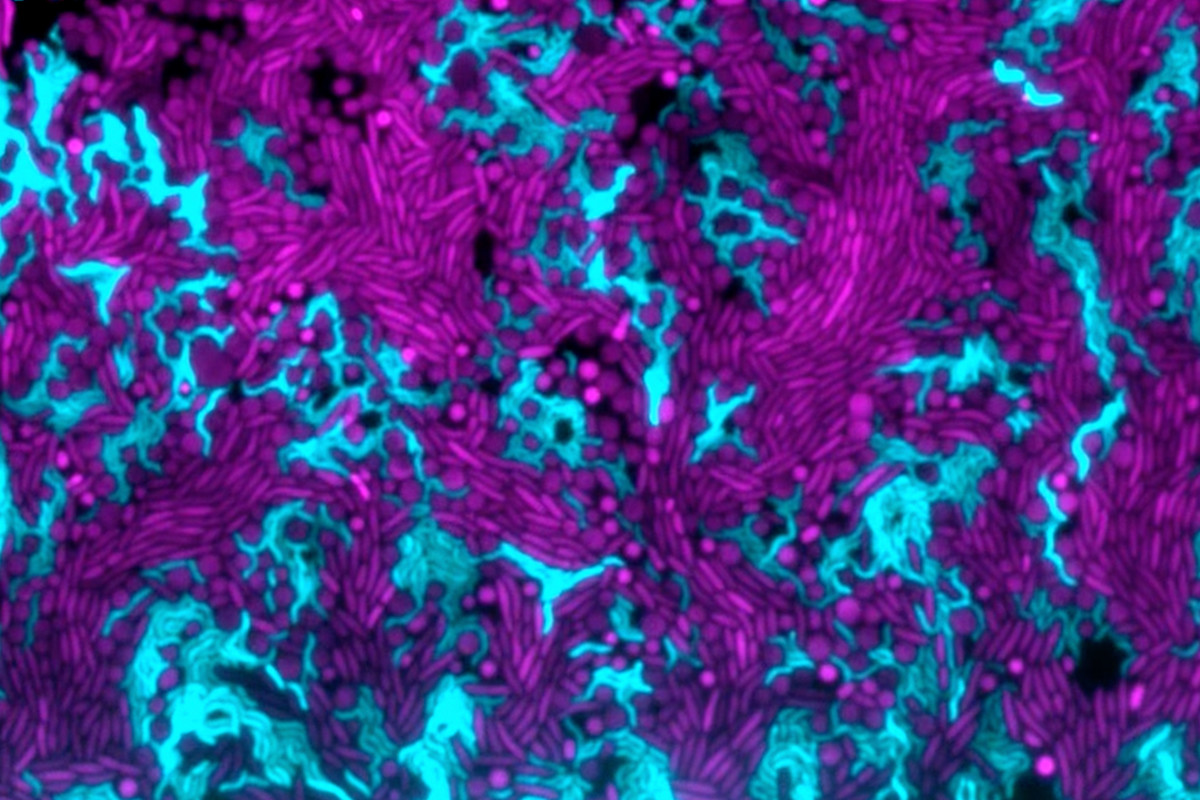 Hungry Bacteria Hunt Their Neighbors With Tiny, Poison-Tipped Harpoons ...