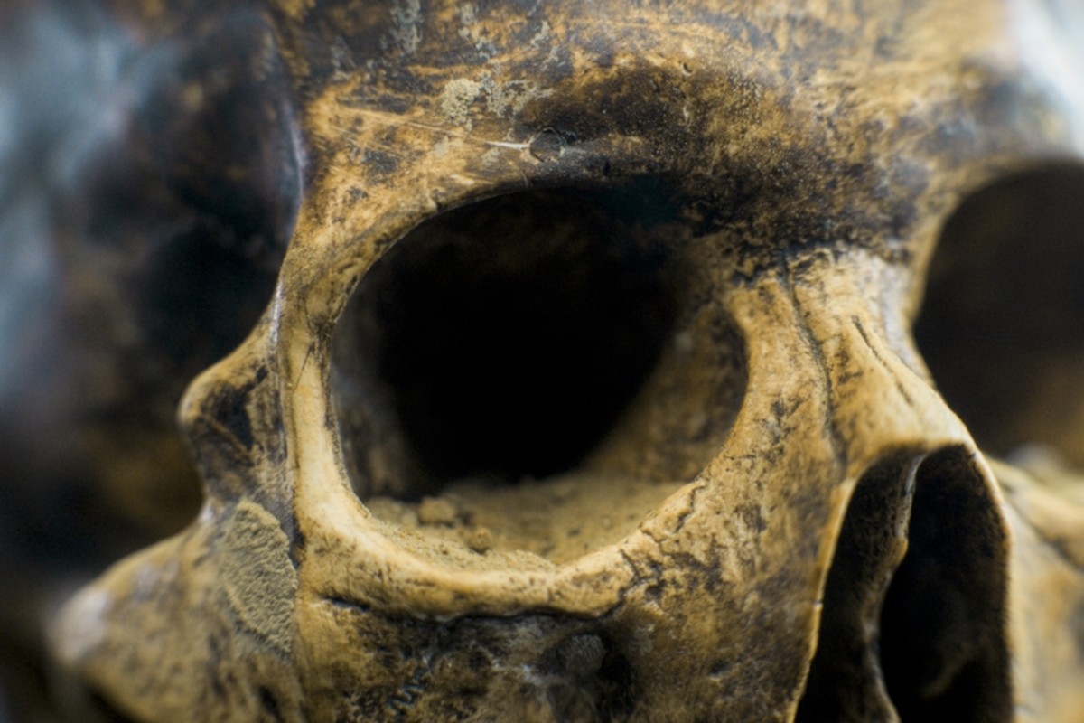146,000-Year-Old Dragon Man Skull Confirmed as Denisovan Through Dental ...