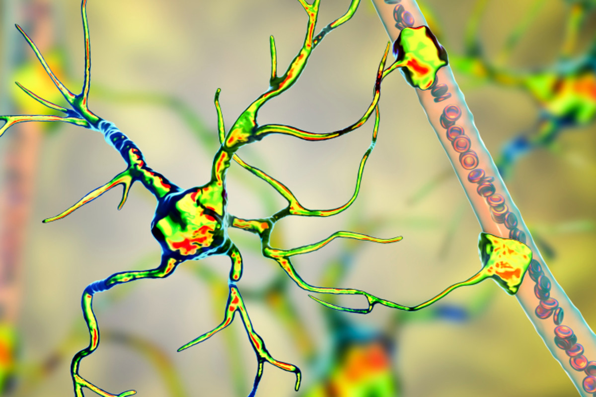 Fully Paralyzed Man with ALS Speaks to Family with First-of-Its-Kind ...