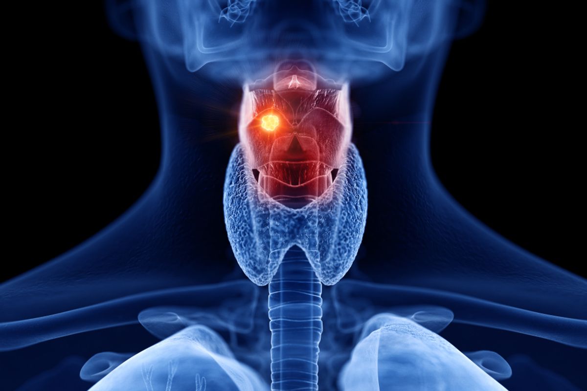 AI May Soon Detect Laryngeal Cancer Just by Listening to Your Voice ...
