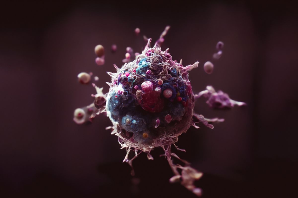 Ultrasound Can Blast Tumors Without Surgery and Is Already Approved for ...