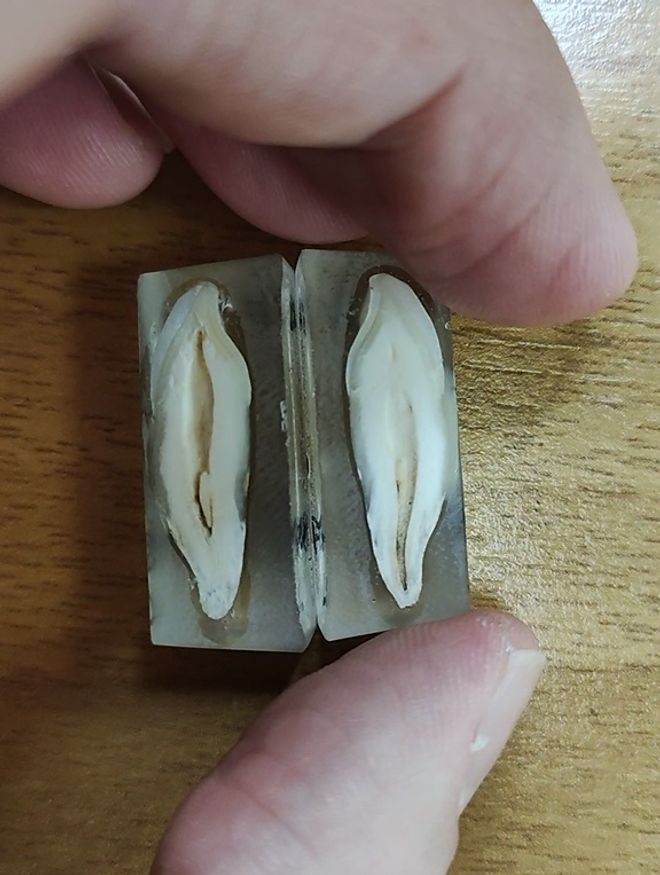2,500-Year-Old Iron Age Teeth Reveal How Ancient Childhoods and Diets ...