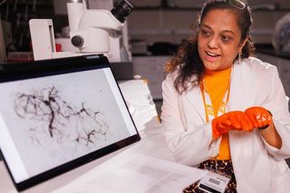 Proteins in Tick Saliva Help Diseases Spread — a Promising Vaccine May ...