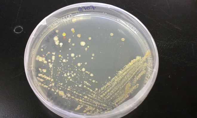 Microbial Dark Matter Is an Unknown World That Exists in Earth's ...