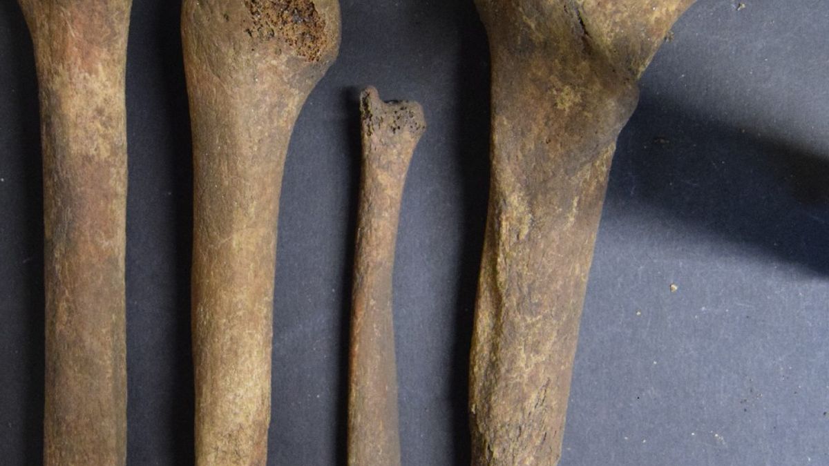 Scottish Burial Site Suggests an Iron Age Woman’s Brain Was Removed and ...